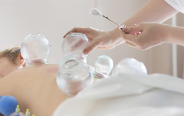 Cupping Therapy FAQs | What, Who, Where, Common Q&A's